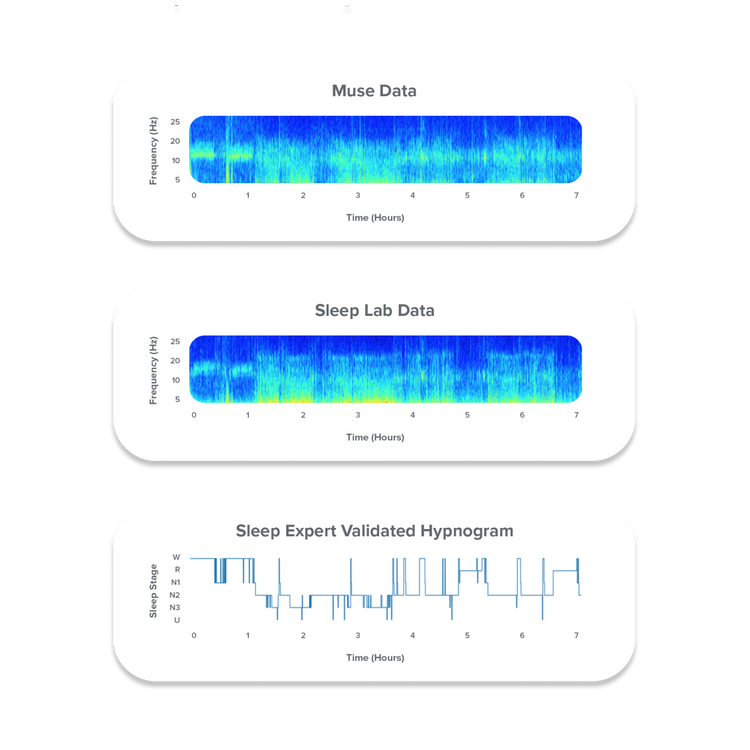 Science | Muse™ EEG-Powered Meditation & Sleep Headband